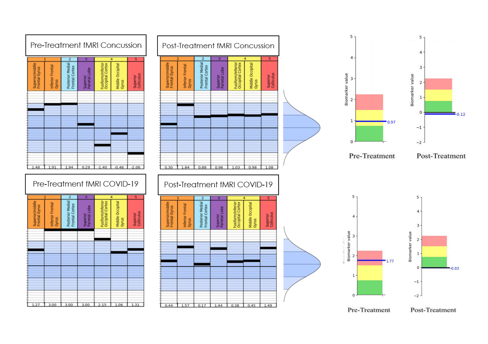 Post COVID Brain Fog Treatment: Think Clearly Again | Cognitive FX